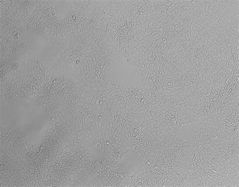 人表皮癌细胞 A 431