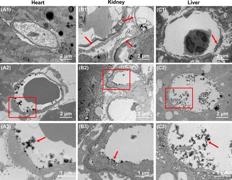 Transmission Electron Microscopy Showing Glycocalyx In Capillaries Download Scientific Diagram