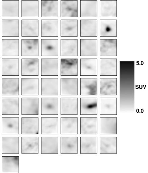 Cross Validation Dataset Middle Axial Slice Of Each Pet Volume Benign
