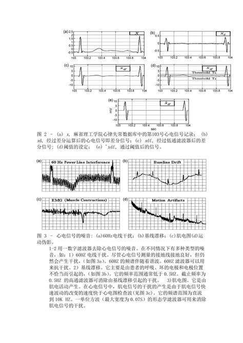 心电信号的QRS波群检测差分运算方法