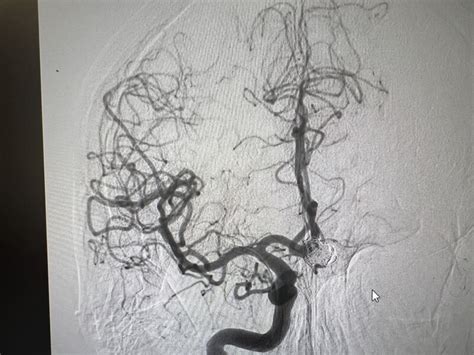 Veysel Kaya On Linkedin Pipeline