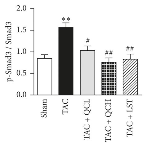 Effects Of Qc On The Cardiac Tgf β1smad Pathway After Tac Surgery In