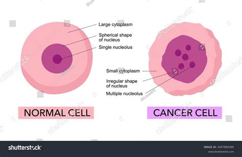 Cancer Cell Normal Cell Comparison Difference Stock Vector Royalty