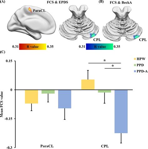 Whole Brain Voxel Wise Correlation Analyses Were Used To Identify The