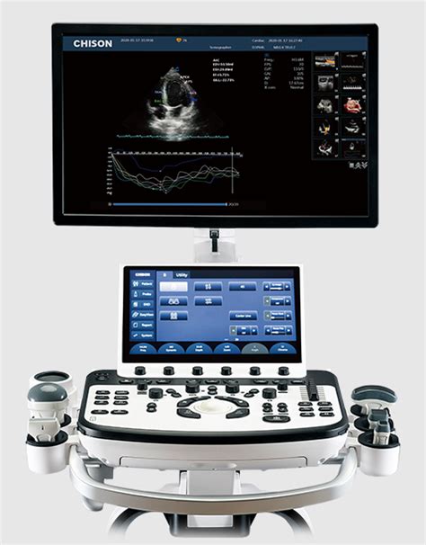Select Your Perfect Cart Based Ultrasound Machine