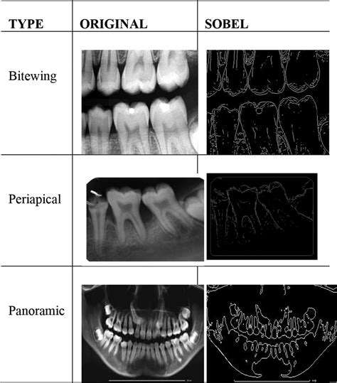 Cadaver Identification With Dental Radiographs Using Isoperimetric And