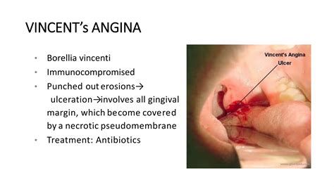 Benign Lesions Of Oral Cavitypptx