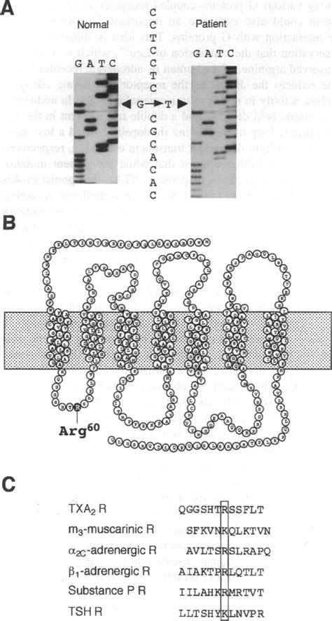 Missense Mutation In The Txa2 Receptor Of The Patient T T A