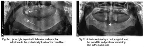 A F Pr Shows The Most Common Pathologic Conditions In The Study