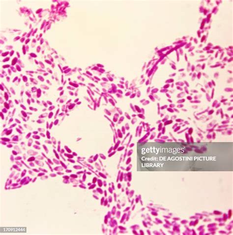 Acetobacter Aceti Photos And Premium High Res Pictures Getty Images