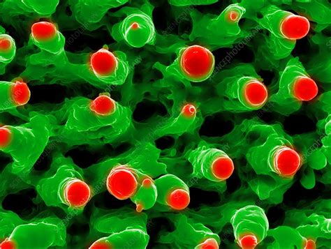nanostructures on metal sem stock image f041 9037 science photo