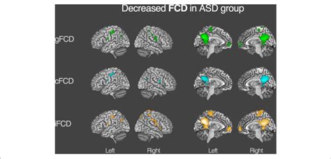 Decreased Functional Connectivity Density Fcd In Autism Spectrum Download Scientific