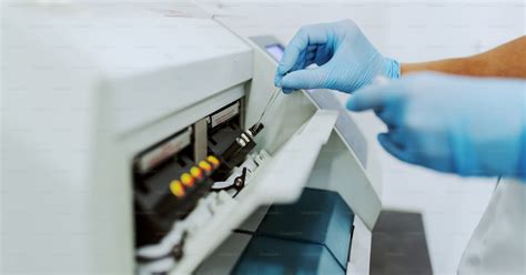 멸균 고무 장갑을 낀 실험실 조교가 소변 샘플을 기계에 떨어뜨리는 모습을 닫습니다 사진 Unsplash의 과학 실험 이미지