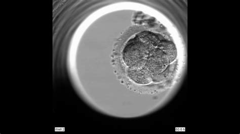Blastocyst Seen With Embryoscope Youtube