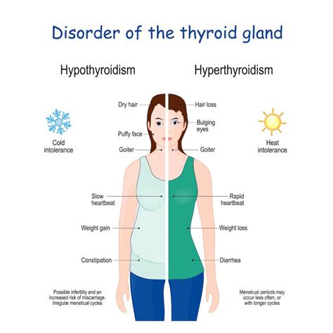 Can You Dye Your Hair With Thyroid Problems At Heidi Dufour Blog