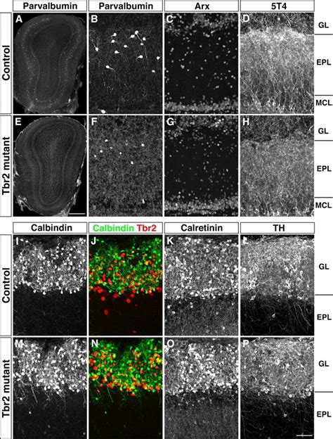 Tbr2 Deficiency In Mitral And Tufted Cells Disrupts Excitatory Inhibitory Balance Of Neural