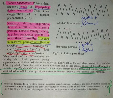 Histology Slides Database Pulsus Paradoxus