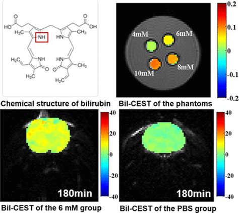 Visualization Of Unconjugated Bilirubin In Vivo With A Novel Approach