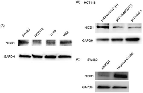 Notch1 Activates The Wnt β Catenin Signaling Pathway In Colon Cancer Oncotarget