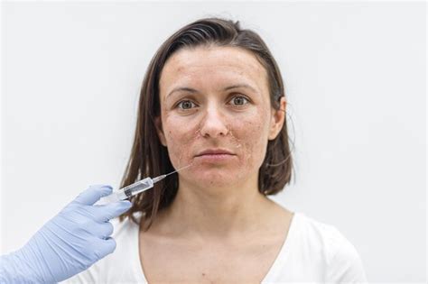 Premium Photo Close Up Photo Of Woman With Dry Skin And Hand In