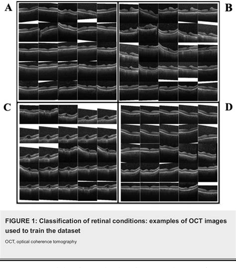 Figure 1 From Evaluation Of Convolutional Neural Networks Cnns In