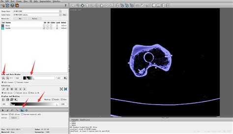 如何用amira分割dicom图像 dicom分割 csdn博客