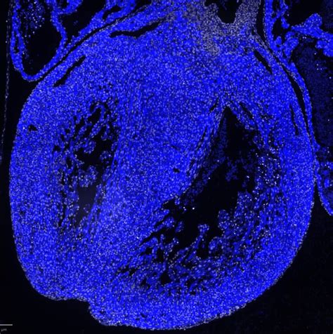 Qupath Area Analysis Without Taking Along Autofluorescent Immunecells