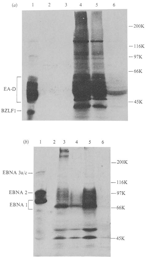 Ebv Gene Expression In Hl A Immunoblot Showing Predominant
