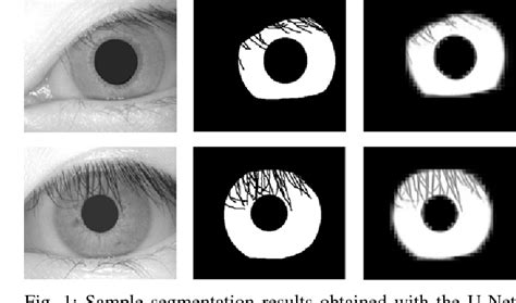 Figure From End To End Iris Segmentation Using U Net Semantic Scholar