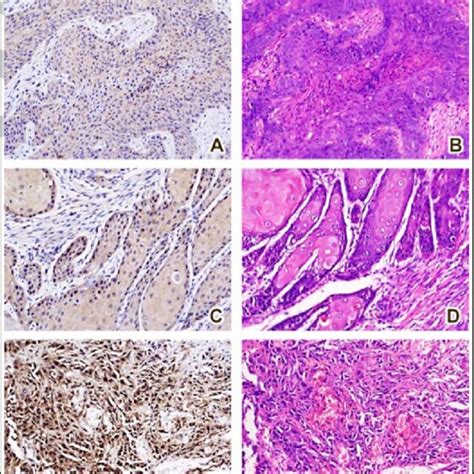 Images A C And E Represents The Immunohistochemical Staining Ihc Of