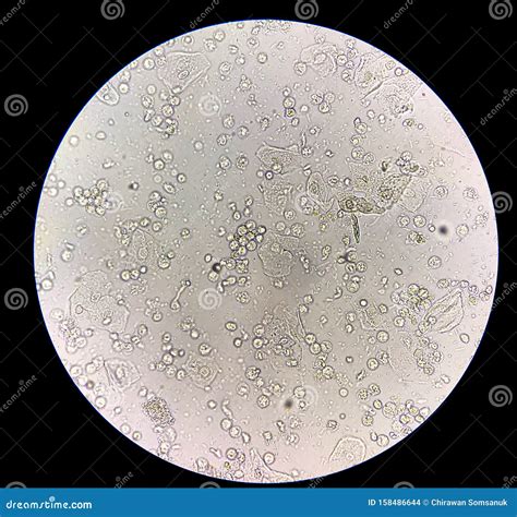 Urine Under Microscope At Laura Granados Blog