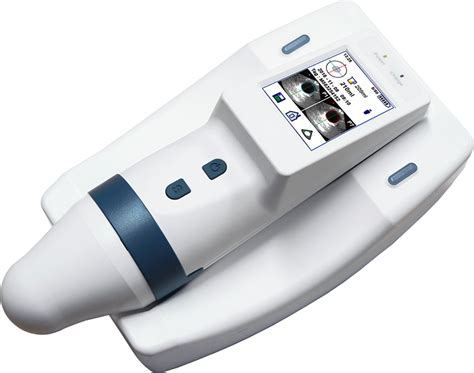 Mcube Biocon 900s Bladder Scanner Ecomed
