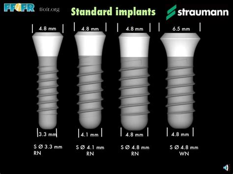 Implant Components And Basic Techniques3