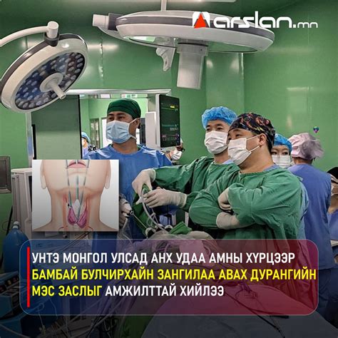 АРСЛАН мн УНТЭ Монгол Улсад анх удаа амны хүрцээр бамбай булчирхайн зангилаа авах ДУРАНГИЙН