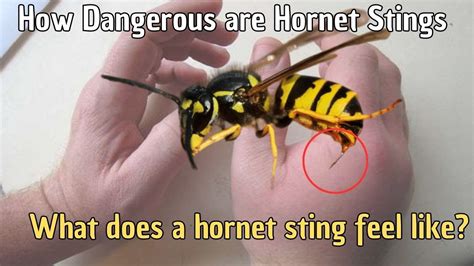 How Dangerous Are Hornet Stings 🐝 What Does A Hornet Sting Feel Like