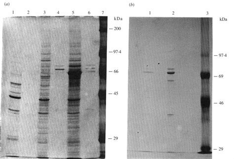 A Comparison Of Deae Cellulose And Atp Agarose Column Eluates Of
