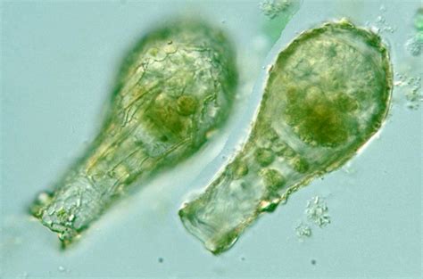 Protist Images Difflugia Oblonga