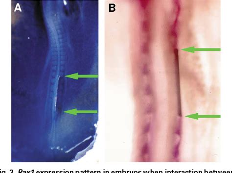 Figure 2 From Three Developmental Compartments Involved In Rib Formation Semantic Scholar