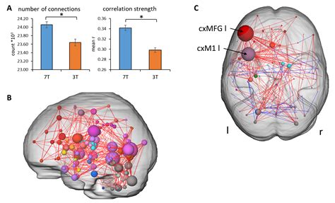 Fig 2 Finger Tapping Motor Task A Statistical Parametric Group Maps