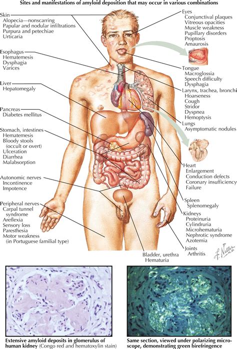 Genodermatoses And Syndromes Clinical Tree