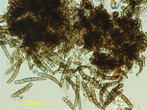 Spruce Stigmina Cooperative Extension Insect Pests Ticks And