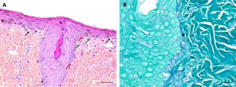 Histological Microphotographs Of Cutaneous Lesions A Interface