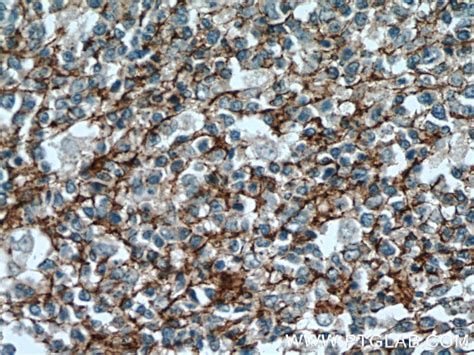 Cd63 Antibody 25682 1 Ap Proteintech