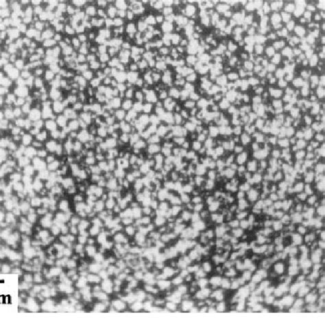 Optical Microstructure Of Undoped Alloy Showing Dendrites Of A And Download Scientific Diagram