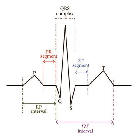 ECG Waveform Flashcards Quizlet