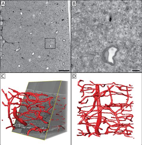 Serial Block Face Scanning Electron Microscopy Sbf Sem Of Biological