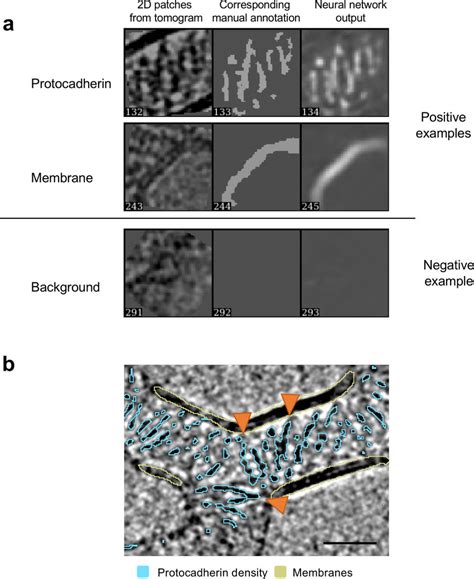 Automated Tomogram Annotation Of Cpcdh Density And Membranes A Download Scientific Diagram