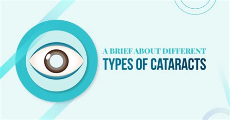 A Brief About Different Types Of Cataracts Global Eye Hospital