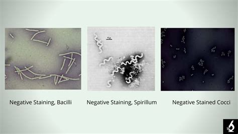Negative Staining Principle Procedure Result Biology Notes Online
