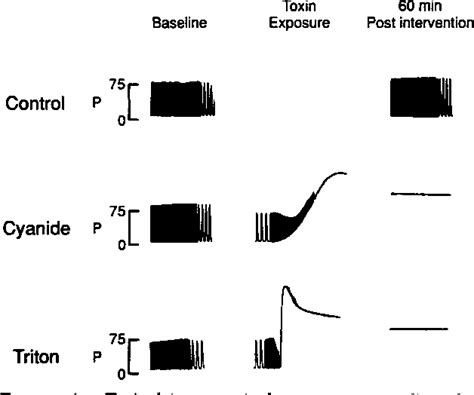 Technetium Tc M Aggregated Albumin Semantic Scholar
